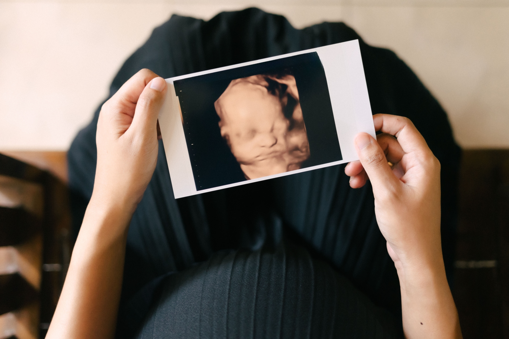 Promo USG 4D 2025: Lihat Si Kecil Lebih Jelas dengan Hemat! - Tuwaga